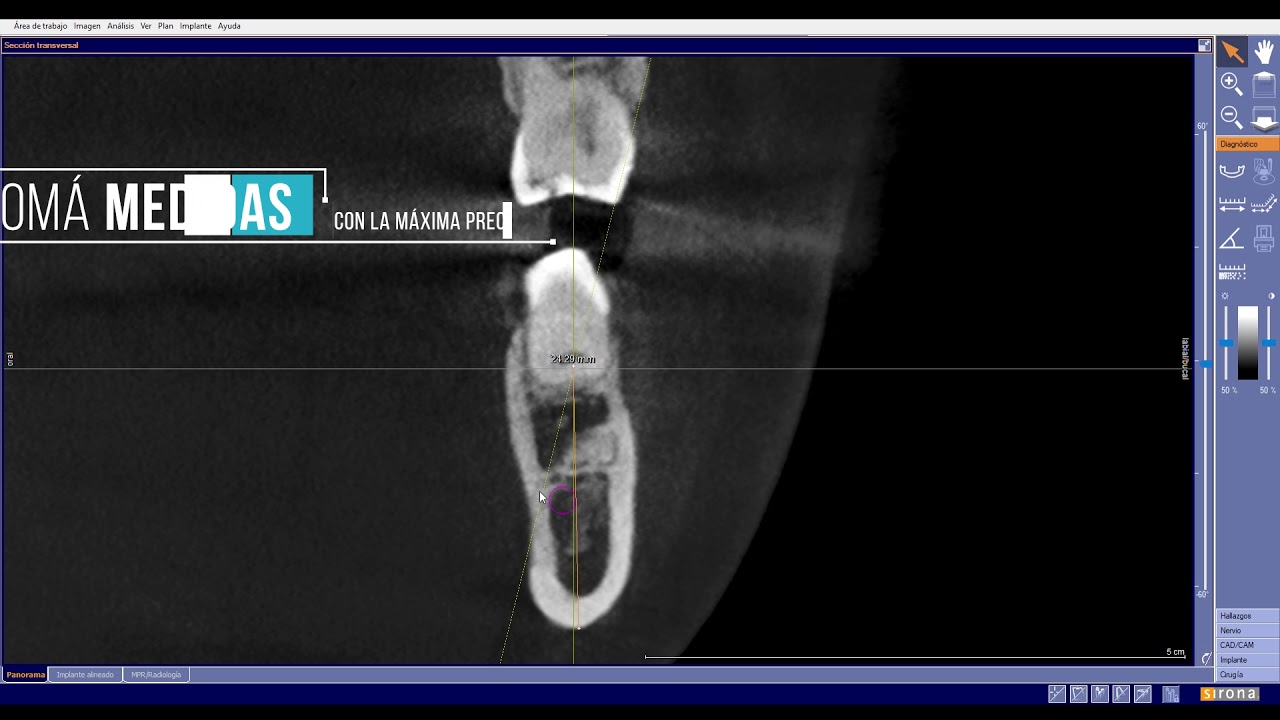 TUTORIAL CEDIM - YouTube