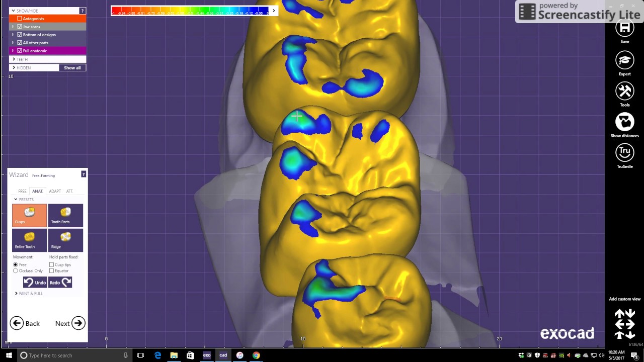 Simple bridge design using Exocad - YouTube