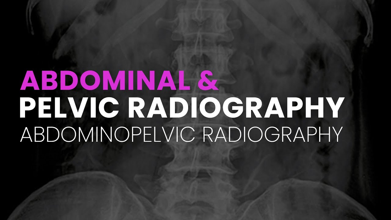 Abdominal and Pelvic Radiography | Abdominopelvic Radiography - YouTube