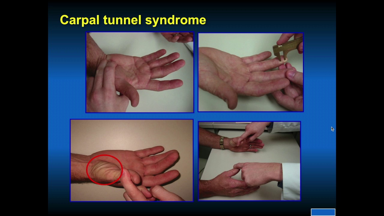 589A Hand and Wrist Exam - YouTube