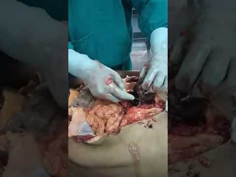 Post mortem - YouTube