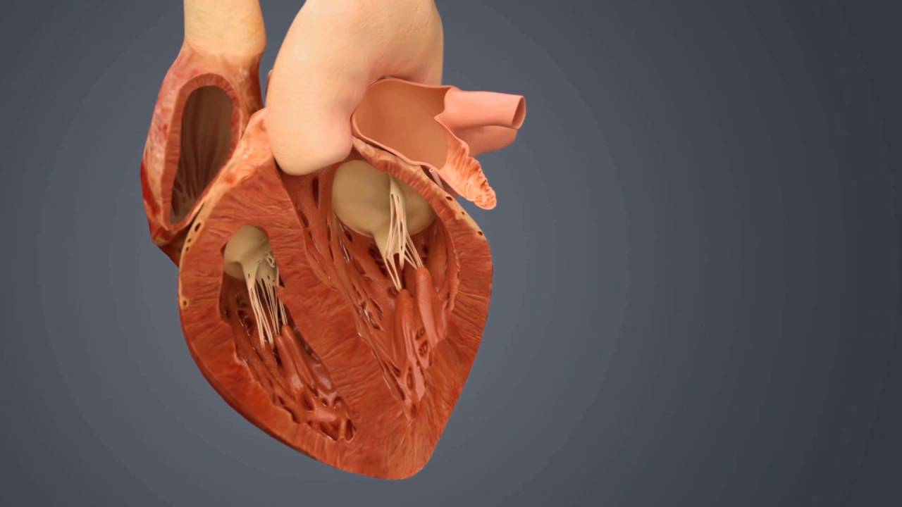 Watchman Device Reduces Stroke Risk for People with Atrial Fibrillation ...