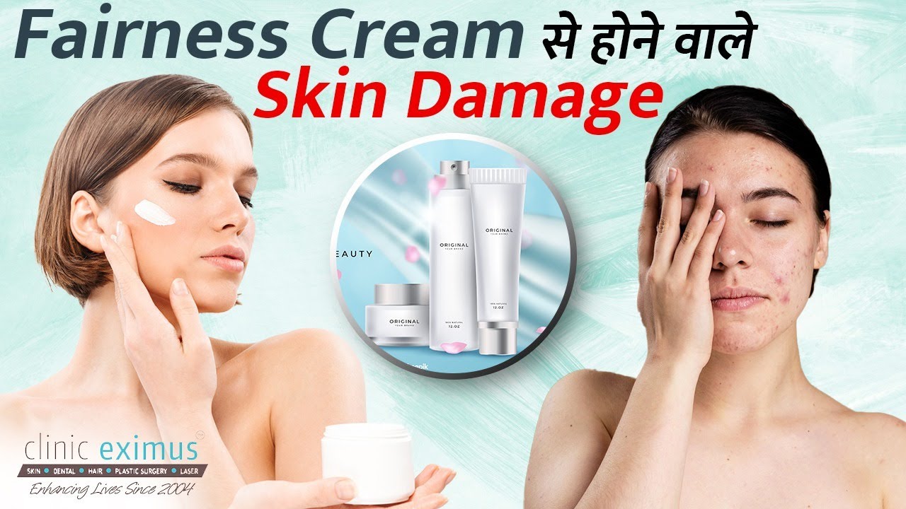 Fairness Cream से होने वाले Skin Damage | How To Repair & Reverse Skin ...