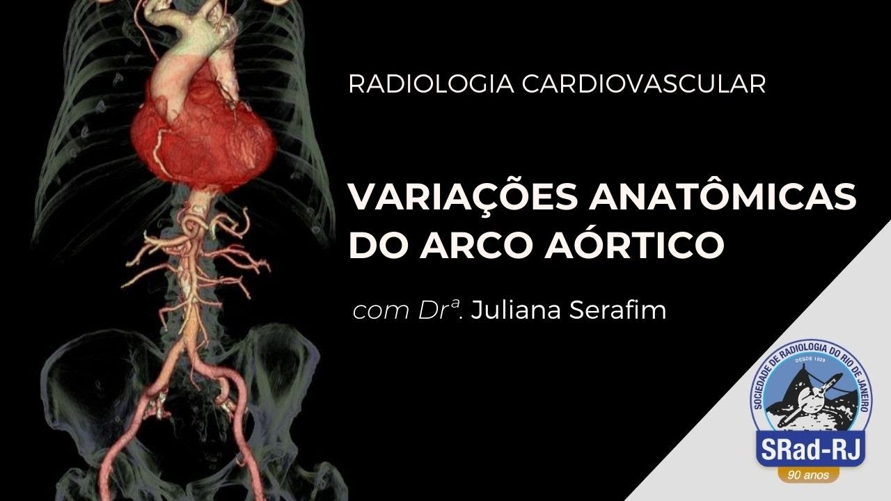 Variações Anatômicas do Arco Aórtico - YouTube