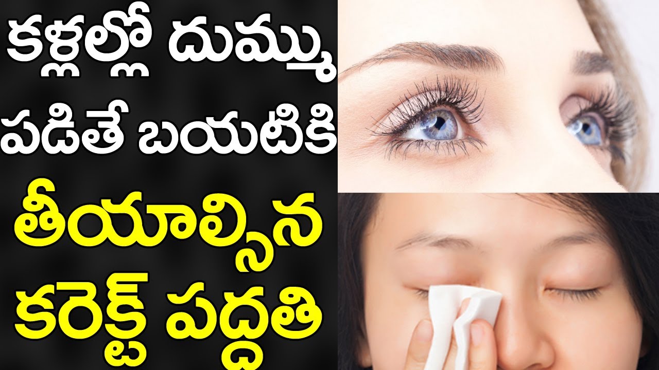 Which Is The Most Healthiest Way To Clean Dirt From Your EYES Best which-is-the-most-healthiest-way-to-clean-dirt-from-your-eyes-best