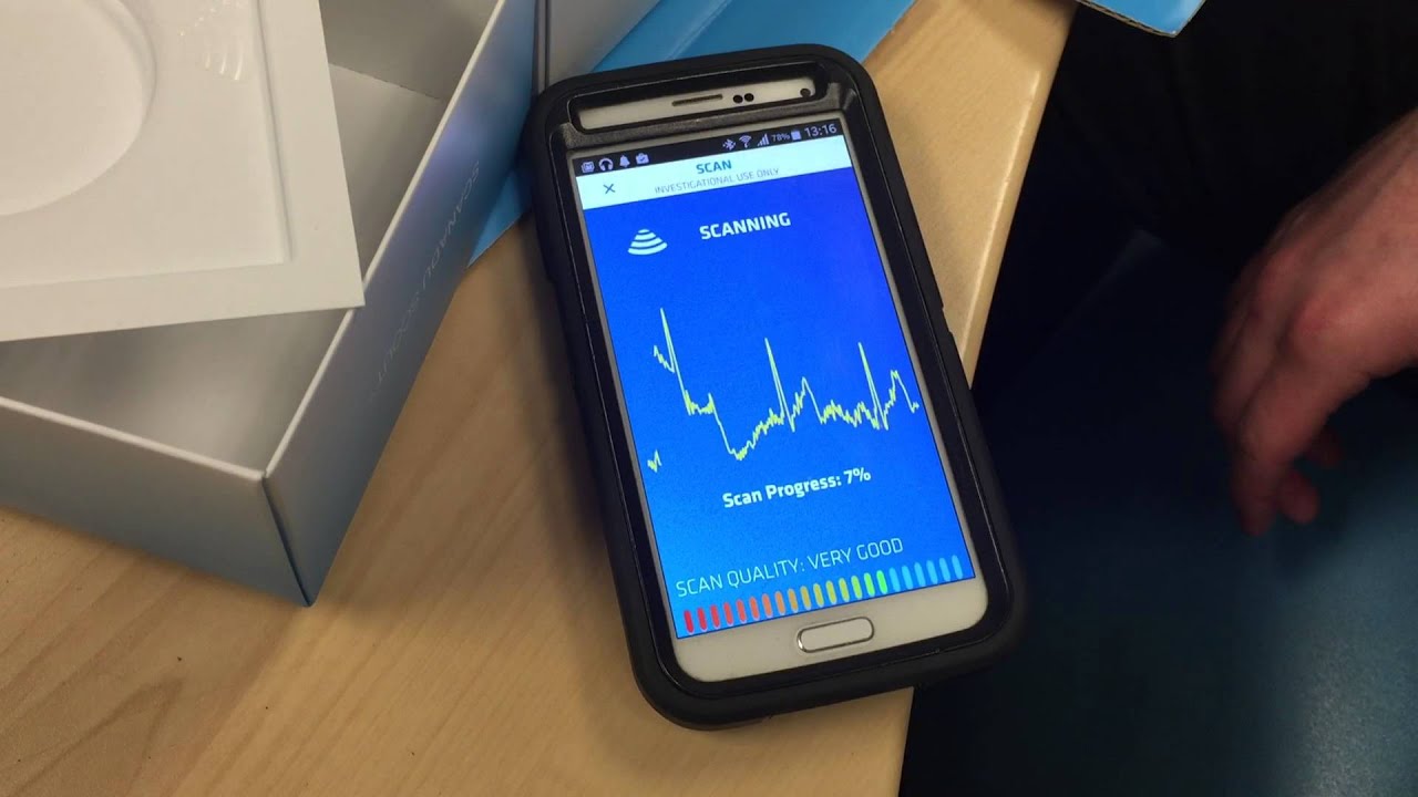 Scanadu Scout - First Look - YouTube