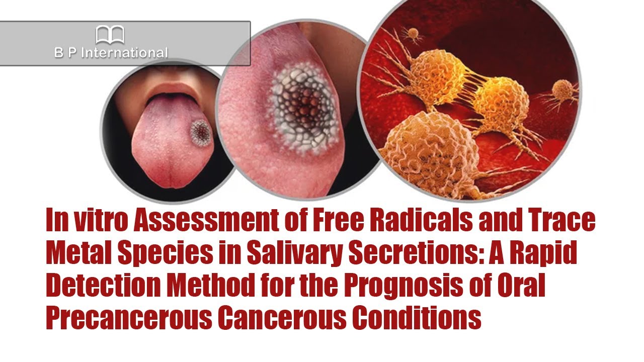 In vitro Assessment of Free Radicals and Trace Metal Species in ...