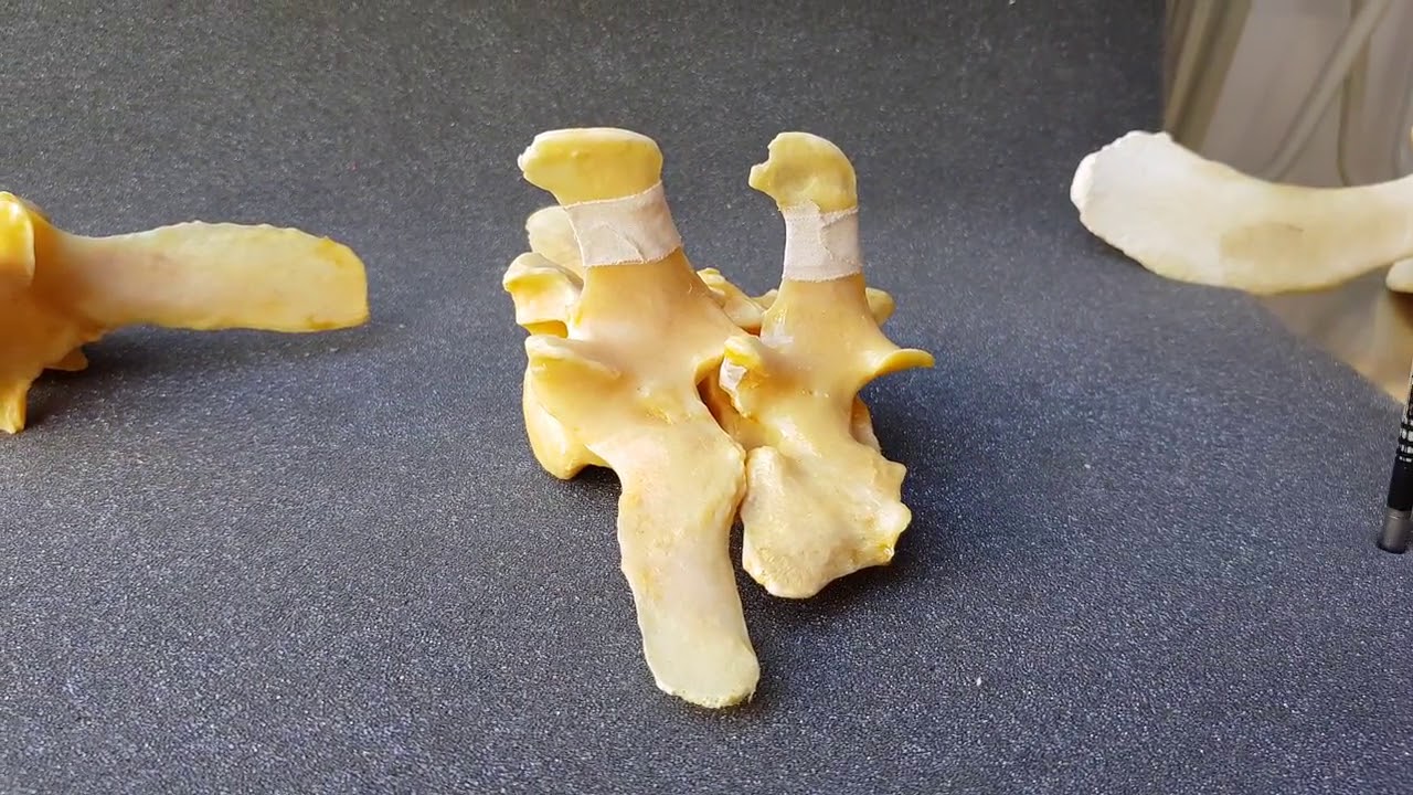 Anatomía Animal Vertebras Lumbares - YouTube