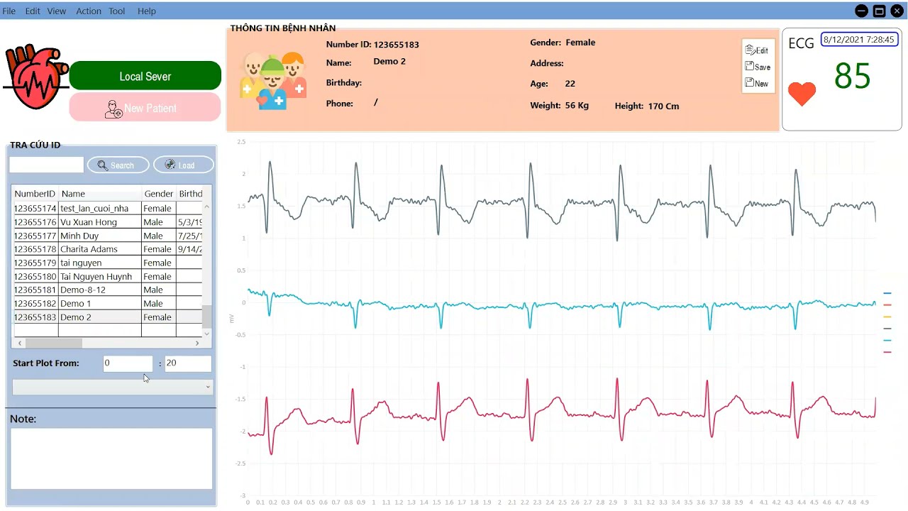 ADS1293 - 12-lead ECG - C# - Arduino Nano - YouTube