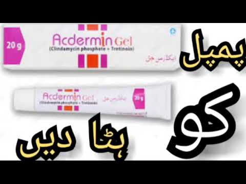 ACDERMIN GEL REVIEW FOR ACNE PIMPLES AND ACNE PRONE SKIN... - YouTube