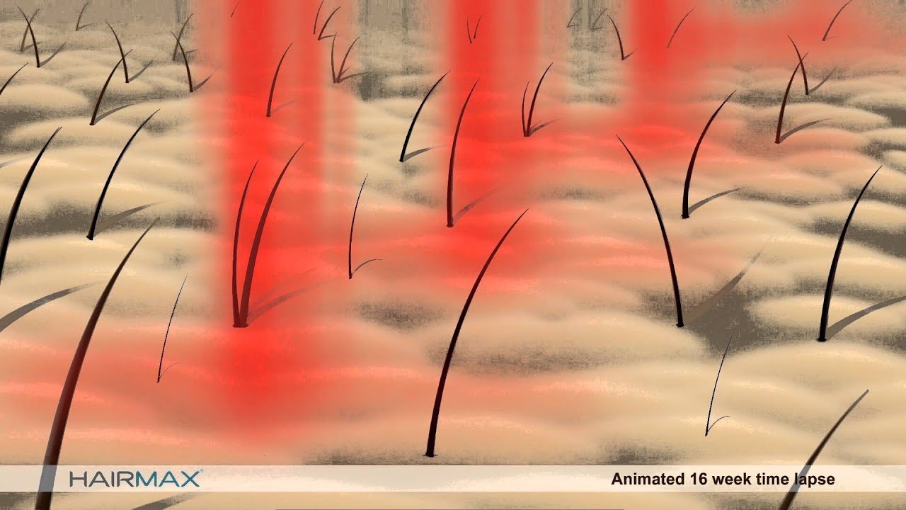 How HairMax works to Regrow Your Hair - YouTube
