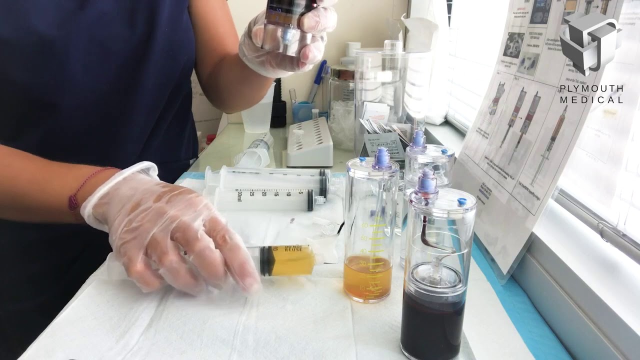 PRP Comparison: EmCyte PurePRP vs EmCyte SP PRP vs Apex Xcell PRP - YouTube