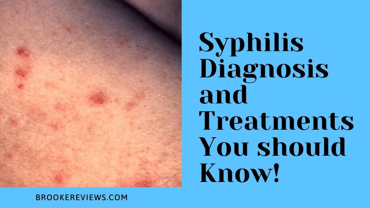 Syphilis Diagnosis And Syphilis Treatment You Should Know Youtube