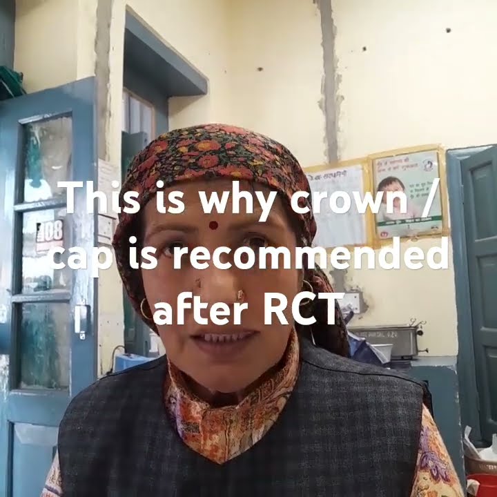 RCT treated tooth with Resto/filling can lasts for years but RCT with ...