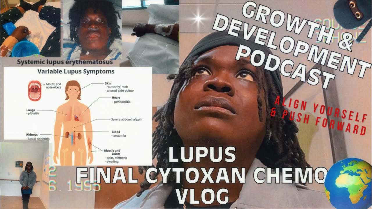 SAHN HOVA | Living Lupus | My Lupus SLE Chemotherapy [VLOG] - YouTube