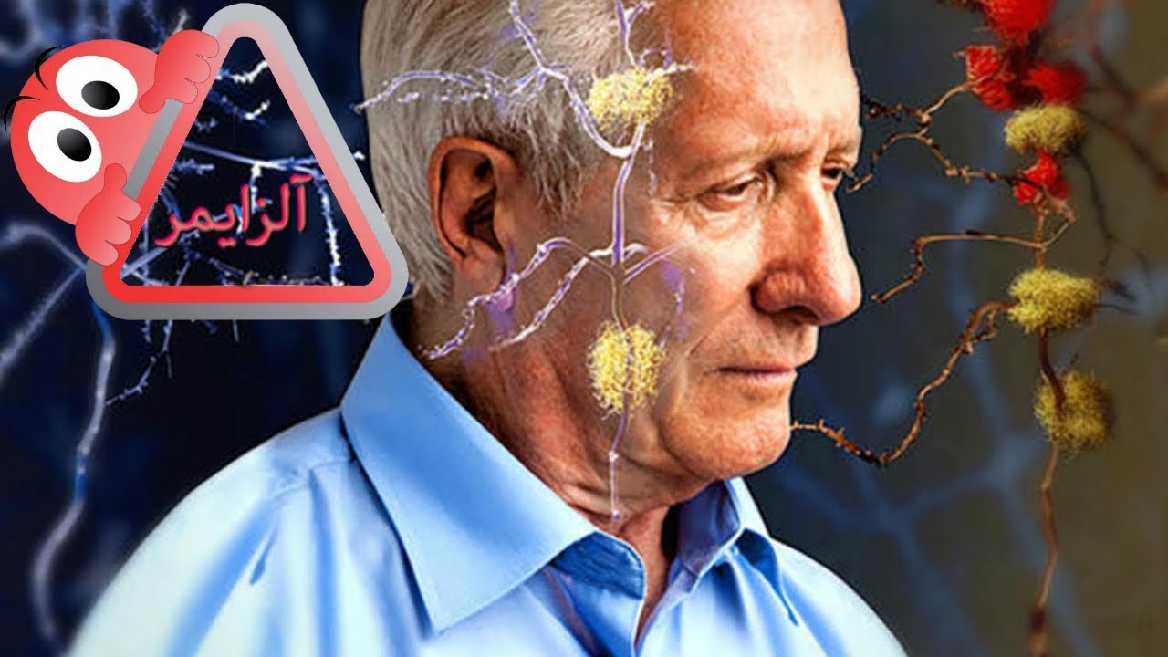 ۱۱ تا از علائم آلزایمر بیماری آلزایمر چیست و از نشانههای آلزایمر چه