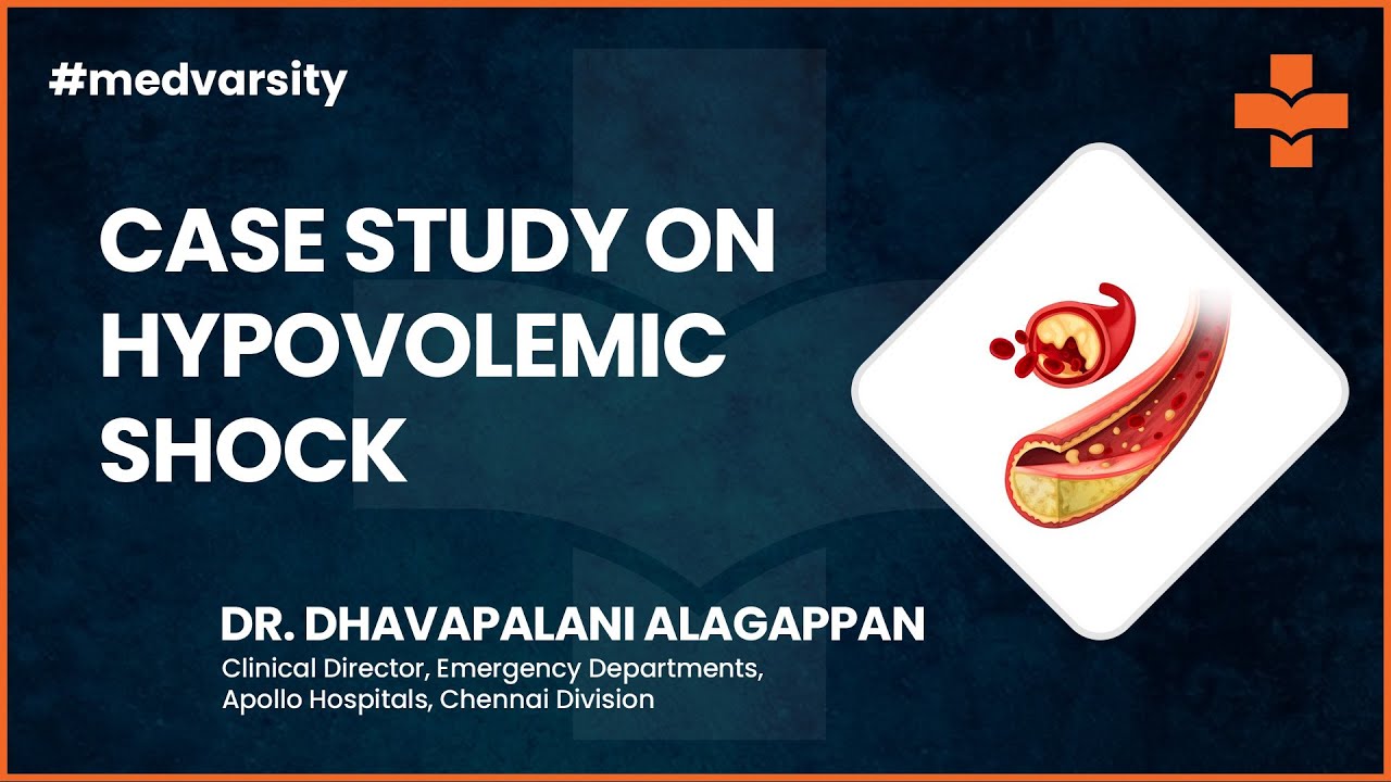Case Study on Hypovolemic Shock | Medical Case Discussion - YouTube