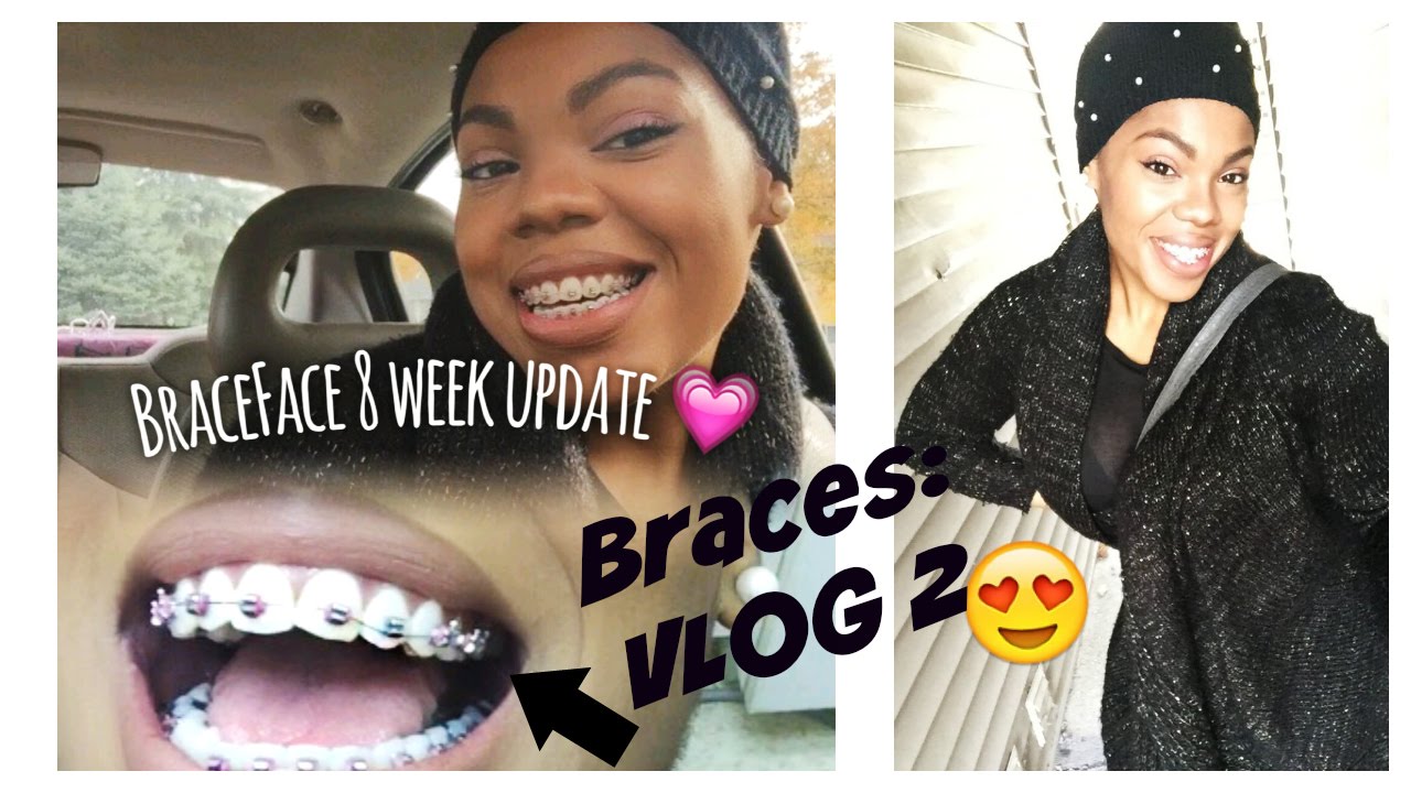 Braces Update First 2 Months In Progress |VLOG 2 - YouTube