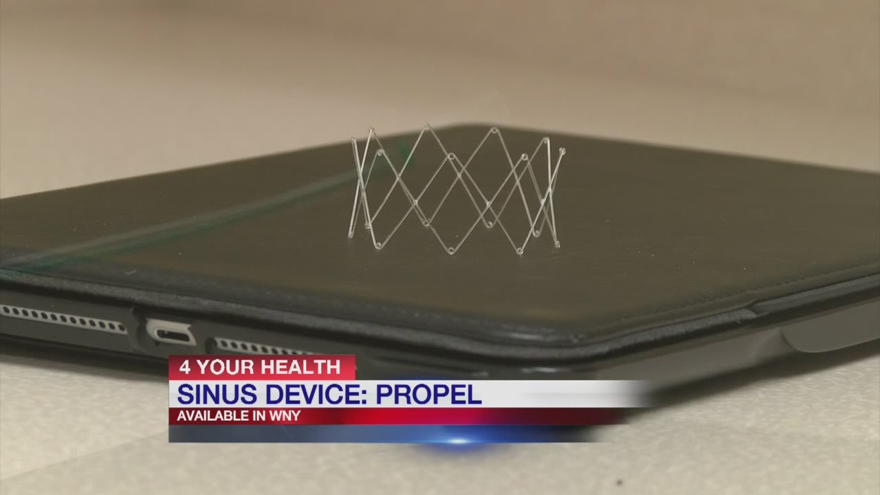 PROPEL medical device helps patients with chronic sinusitis - YouTube