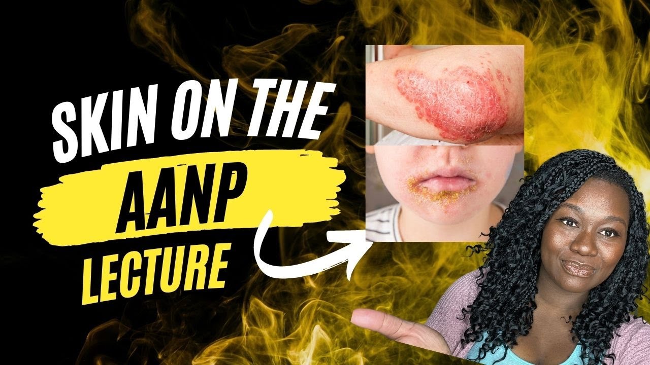 How To Ace The AANP Skin Exam: A Comprehensive Guide - YouTube