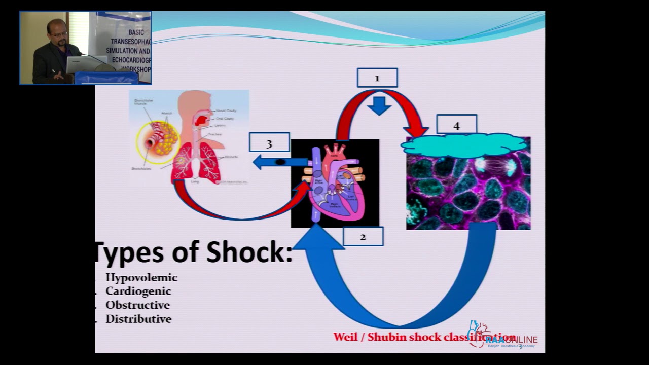 Hemodynamic alterations in different types of shock - YouTube