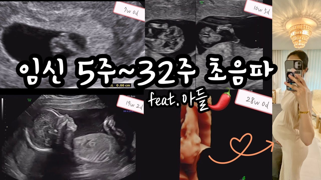 임신10개월 태아초음파 3분 컷👶주수별 검사기록 신비롭고 신기한 초음파 이야기🥹 Youtube