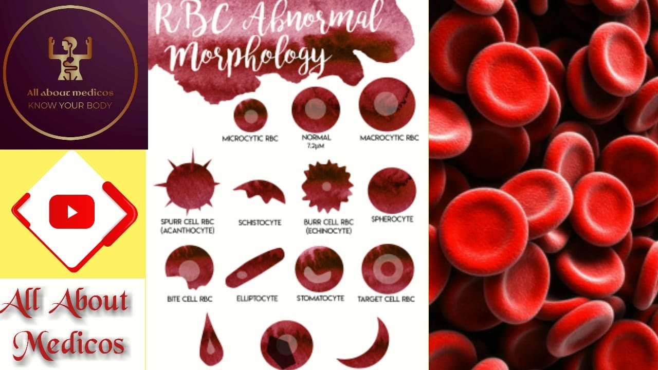 Types Of Rbc Morphology