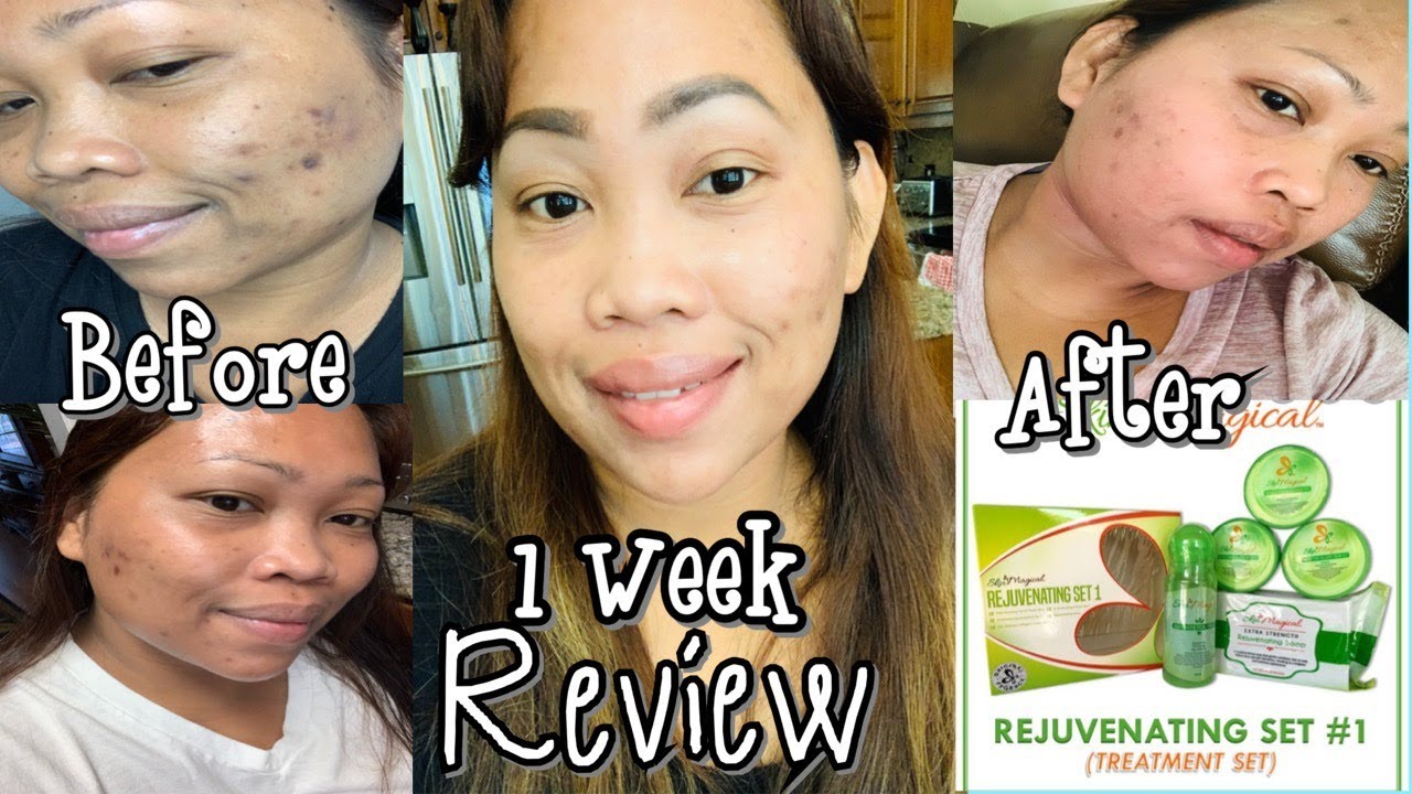 1 WEEK REVIEW SKIN MAGICAL REJUVENATING SET 1 - YouTube