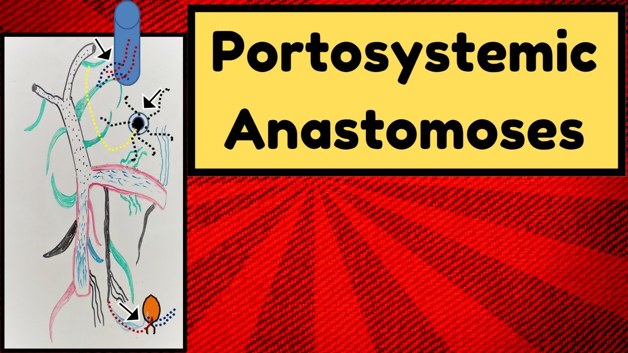 Portosystemic Anastomoses - YouTube