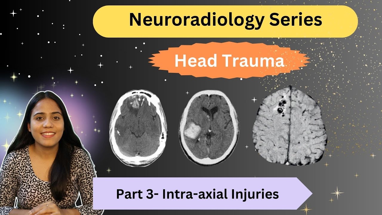 Intra-axial Injuries | Head Trauma Part 3 | Neuroradiodiology | Dr ...