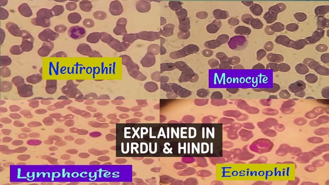 Eosinophil Under Microscope