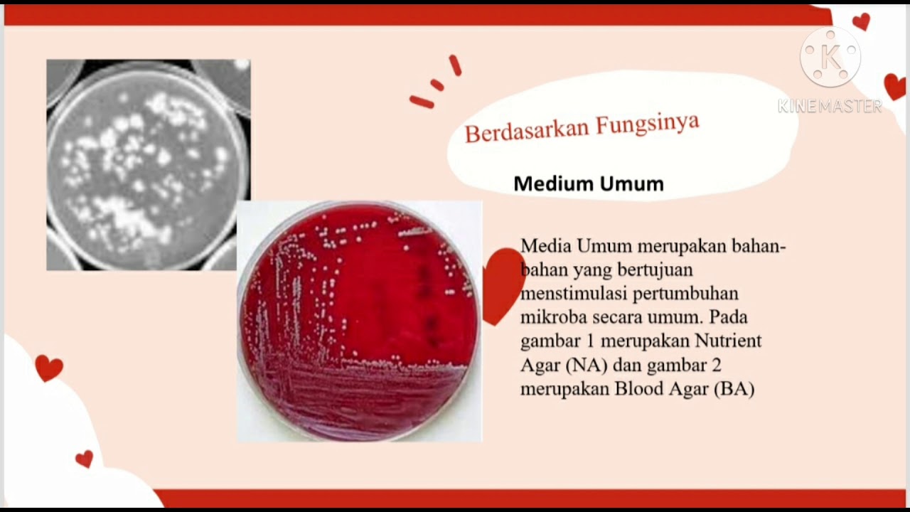 Media Pertumbuhan Bakteri dan Jamur #udayanapjj2020 #fkhunud # ...