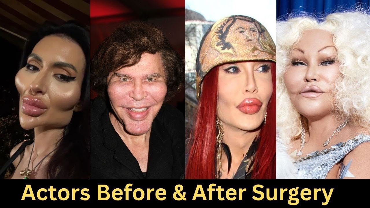 Hollywood actors before and after of plastic surgery - YouTube