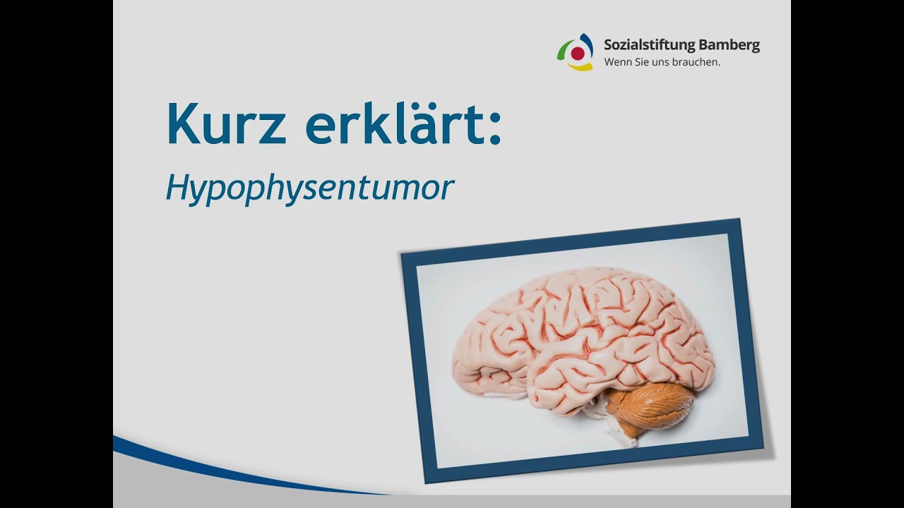 Kurz erklärt: Hypophysentumor - YouTube