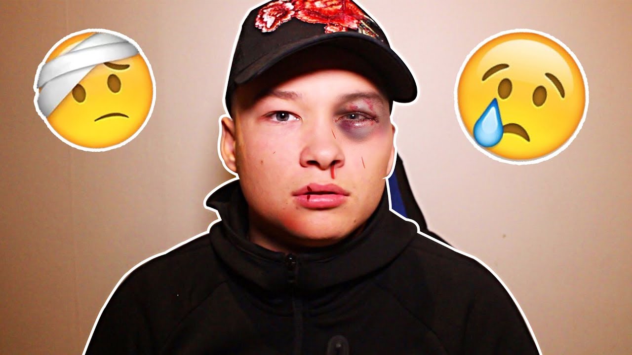 I GOT HEADBUTTED?! [STORY TIME] - YouTube