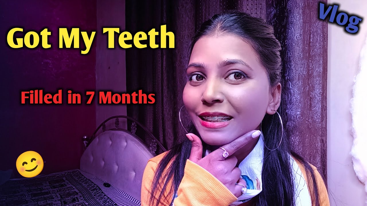 My Braces Journey In Hindi || Got My Teeth Filled In 7 Months || Teeth Braces Before And After ...