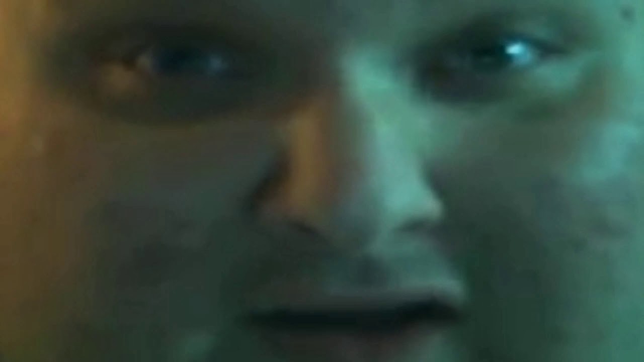 Reverend Burn can't stop having seizures - YouTube