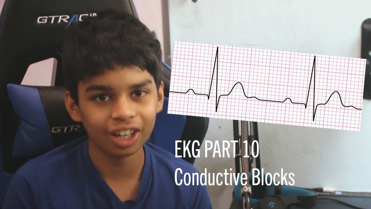 EKG Pt.10 | Conductive Blocks - YouTube