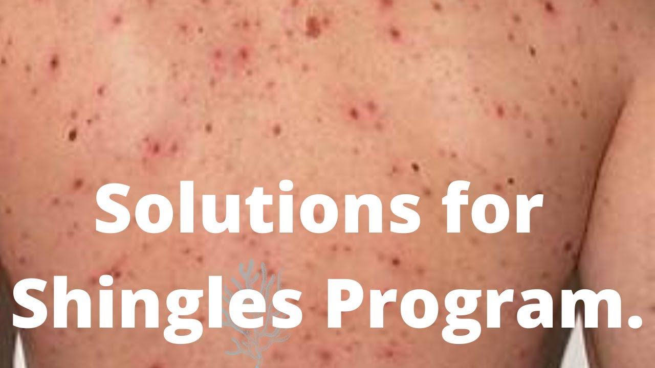 Solutions for Shingles Program. - YouTube