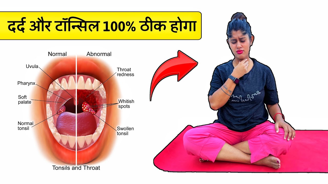 गले का दर्द और टॉन्सिल को खत्म करने के लिए योगासन | Yoga for Tonsil ...