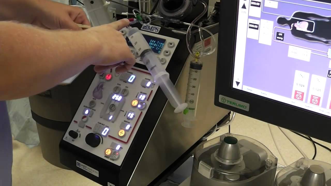Priming A Pump (Terumo System One) Tutorial - YouTube