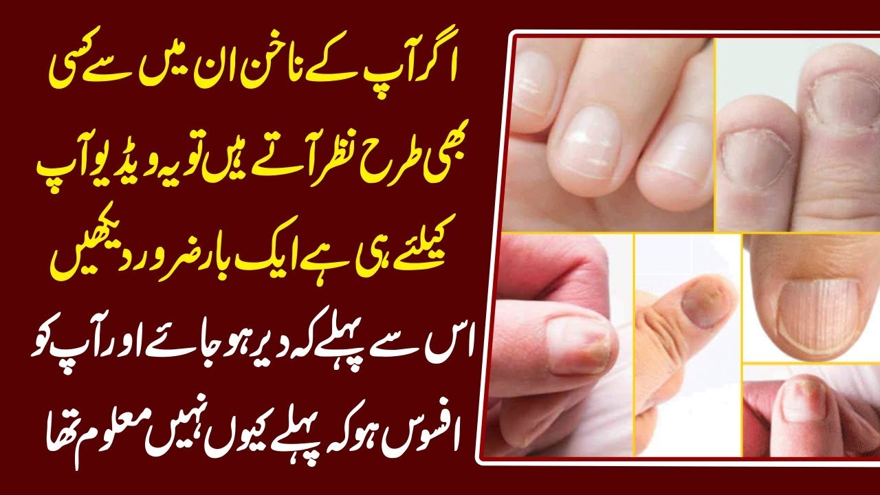 What Your Nails Say About Your Health Ridges White Spots Lines what-your-nails-say-about-your-health-ridges-white-spots-lines