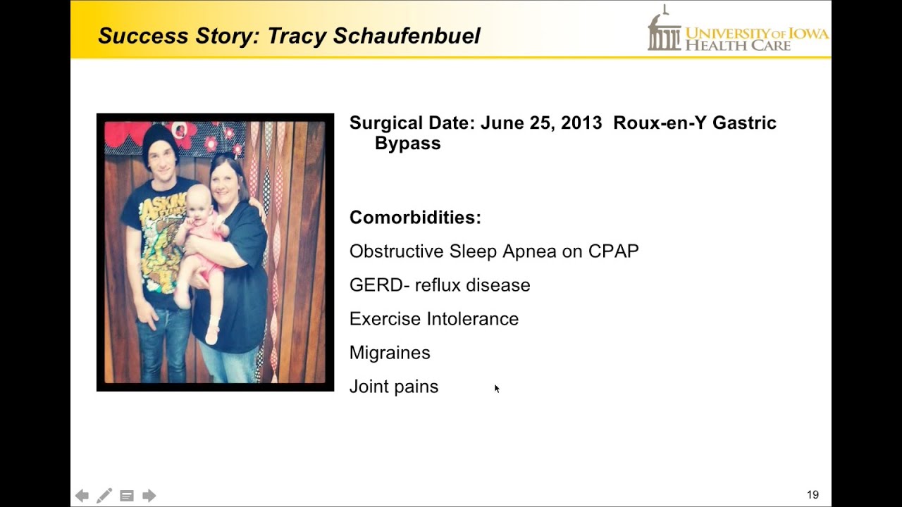 Bariatric Surgery Success Story – Tracy Schaufenbuel - YouTube