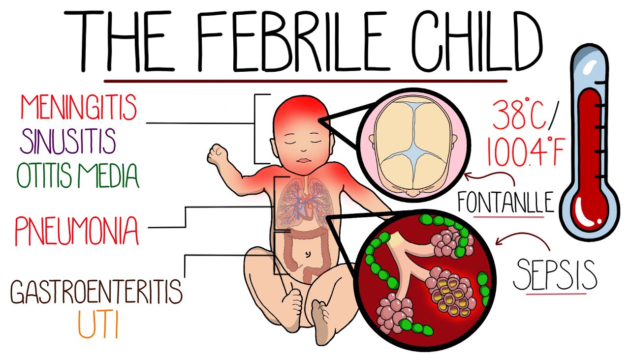 Approach To Fever In Children In 10 Minutes with Red Flags YouTube Approach To Fever In Children In 10 Minutes with Red Flags YouTube