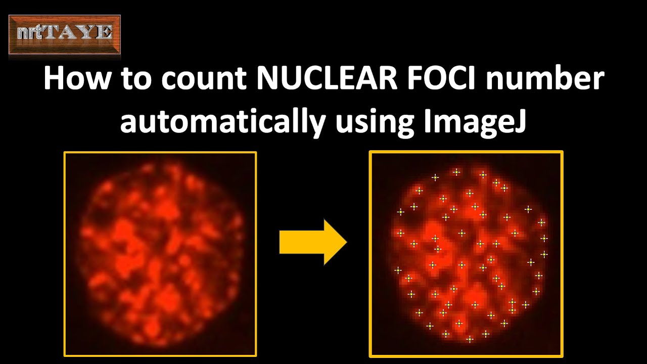 How to count NUCLEAR FOCI numbers automatically using ImageJ - YouTube