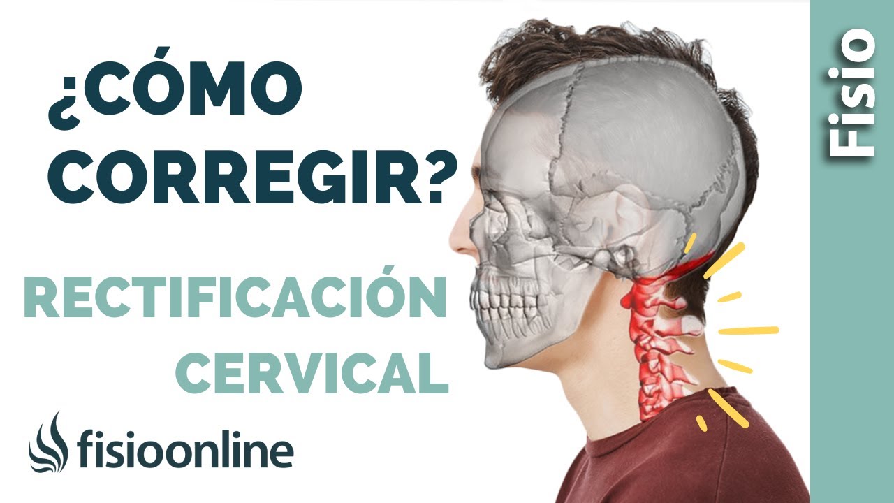 Los 3️⃣ MEJORES EJERCICIOS para la RECTIFICACIÓN CERVICAL - YouTube