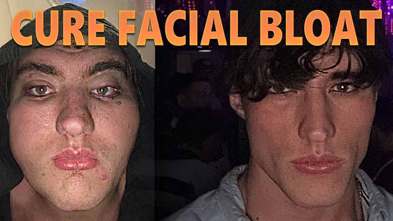 Advanced guide on curing facial bloat - YouTube