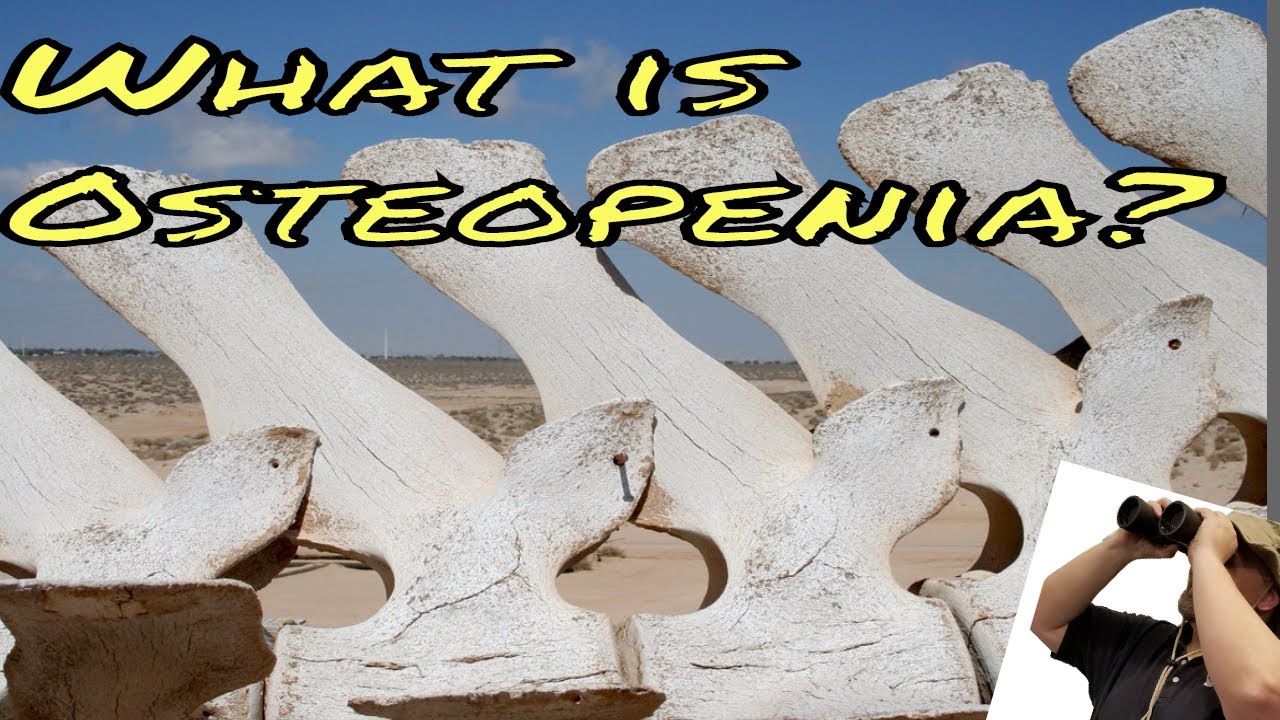 What is Osteopenia? A brief description of what osteopenia and ...