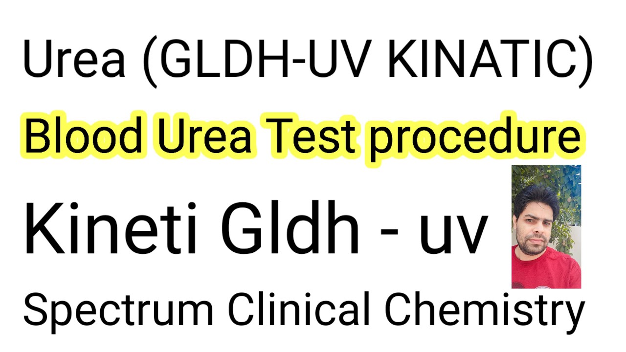 urea test | urea test spectrum reagent | GLDH uv KINATIC | blood urea ...
