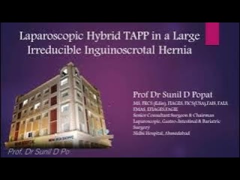 Laparoscopic Hybrid TAPP for Large Right Irreducible Inguinoscrotal ...
